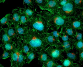 LAS LÍNEAS CELULARES INMORTALES MÁS USADAS - H.W.Kessel